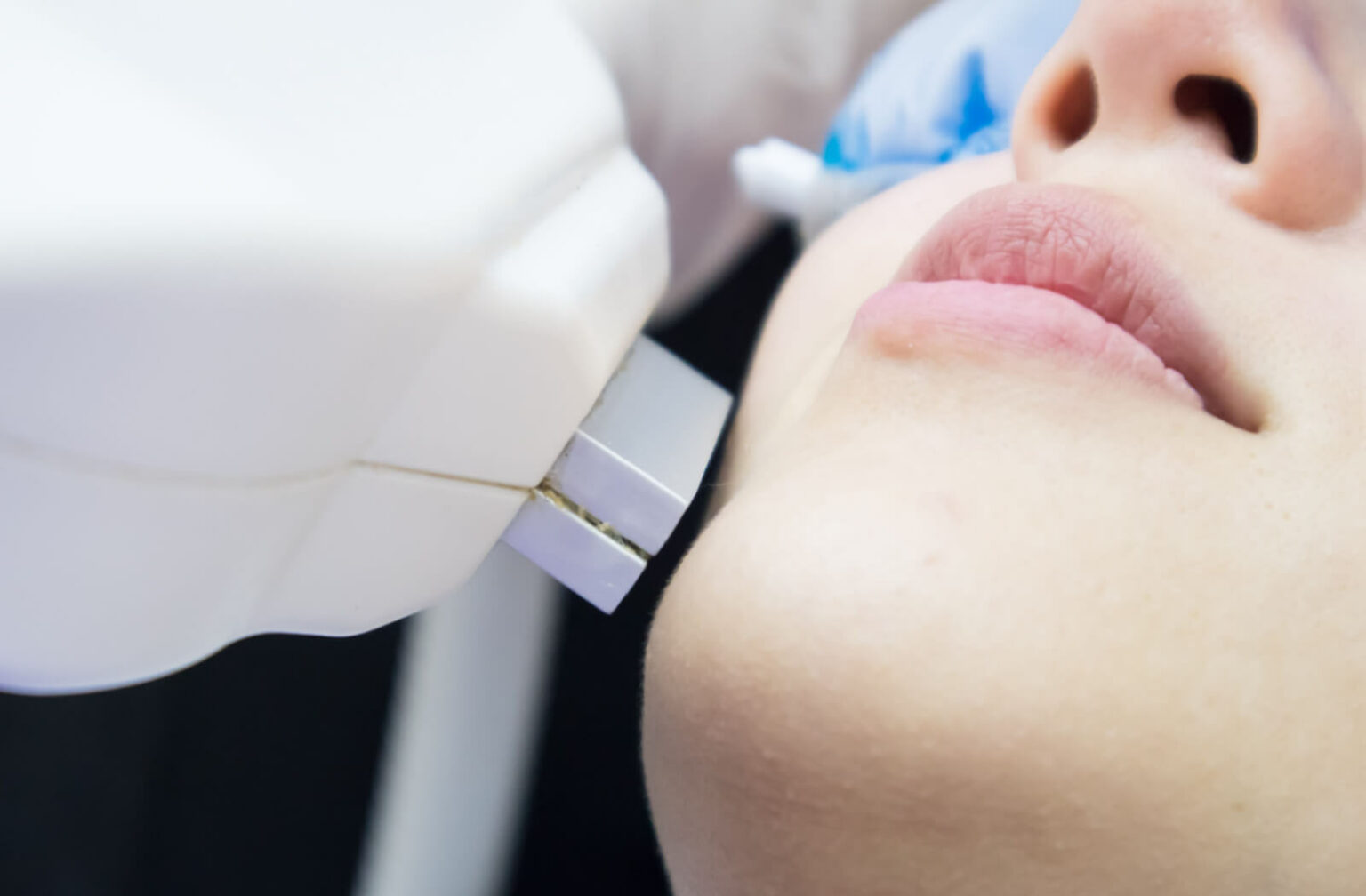 How to Get Rid of Crows Feet Naturally? | Blackfoot, Idaho